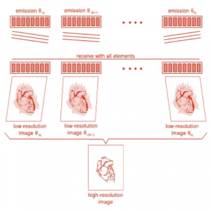 UltraFast Ultrasound Imaging on Versal - MakarenaLabs