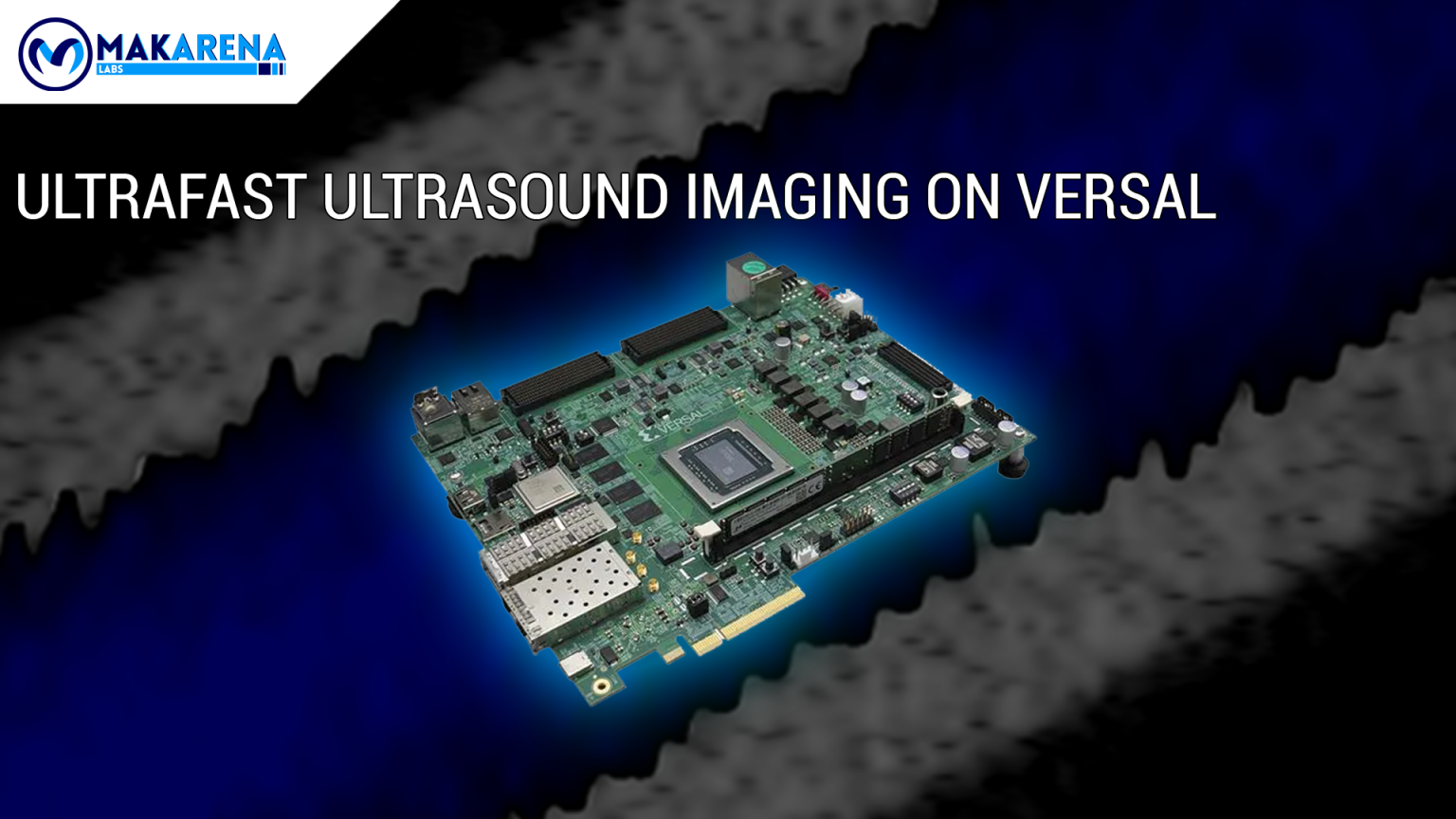UltraFast Ultrasound Imaging on Versal - MakarenaLabs